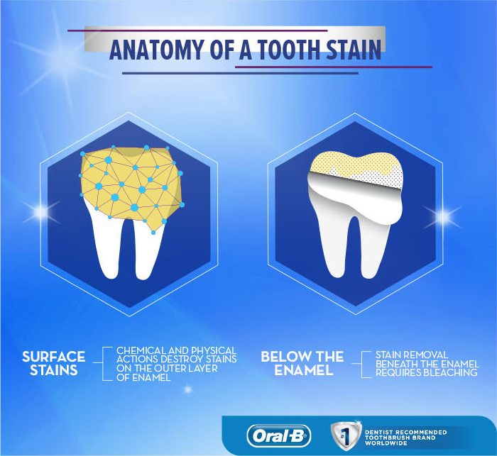 Teeth Stains: Causes, Removal and Whiter Teeth - Oral-B